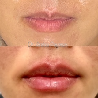 LIP POP, LIP FLIP, BABY LIPS: WHERE NOBODY KNOWS BUT YOU